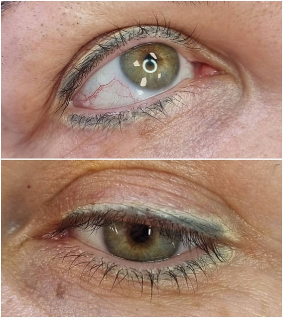 problems with permanent makeup