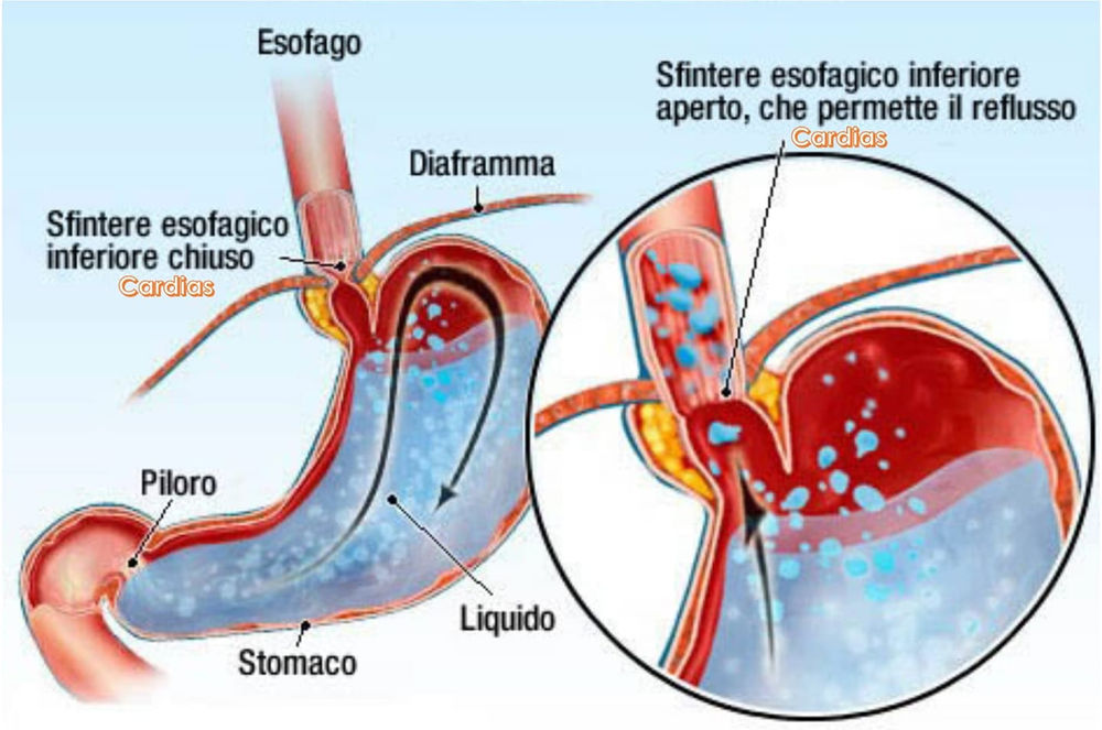 II° Lezione: Stress e apparato digerente - Mucosa esofagea