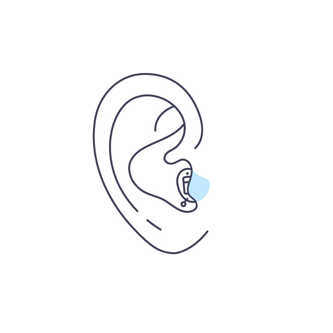Completely-in-Canal (CIC) Hearing Aids | RxHearing