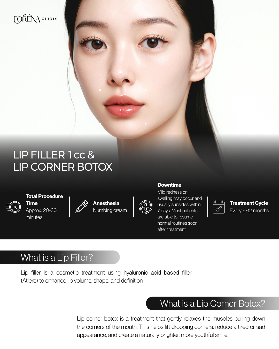 Enhance Your Smile with Lip Filler + Lip Corner Botox