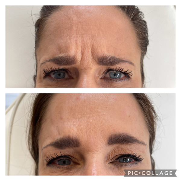 Blank Page | Dr Libby McIntyre Facial Aesthetics