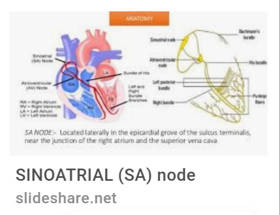 Sinus Node Dysfunction