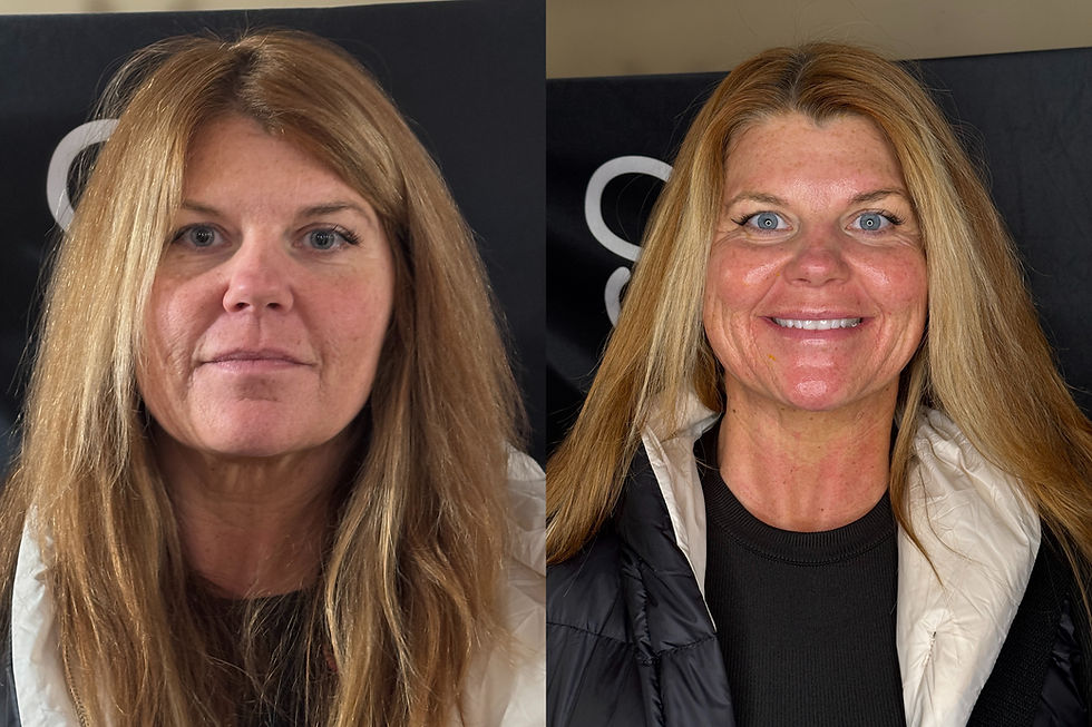 1 Session VAMP: Tightening & Lifting Hydra-Boost Treatment | Dutch ...