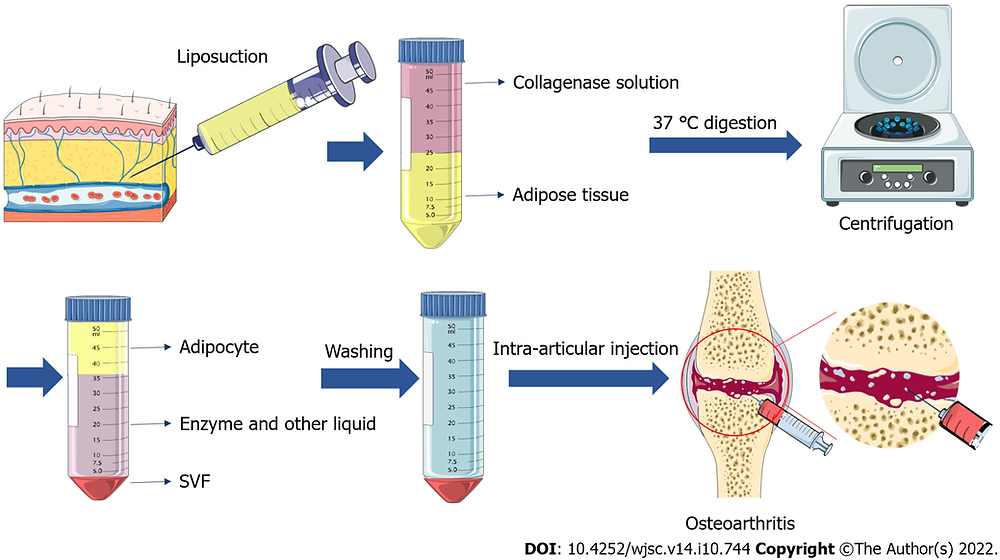 Adipose-Derived SVF Therapy: Step-by-Step Guide for Isolation, Storage ...