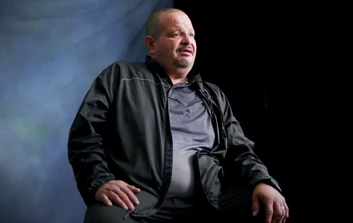 Los Angeles Man with Rare Genetic Condition, Diphallia (born with two ...