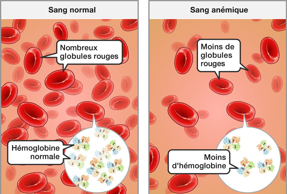 Qu'est ce que le taux d'hémoglobine