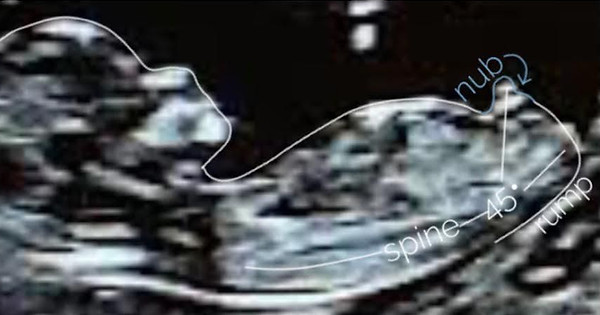 The nub theory explained | The Nubologists