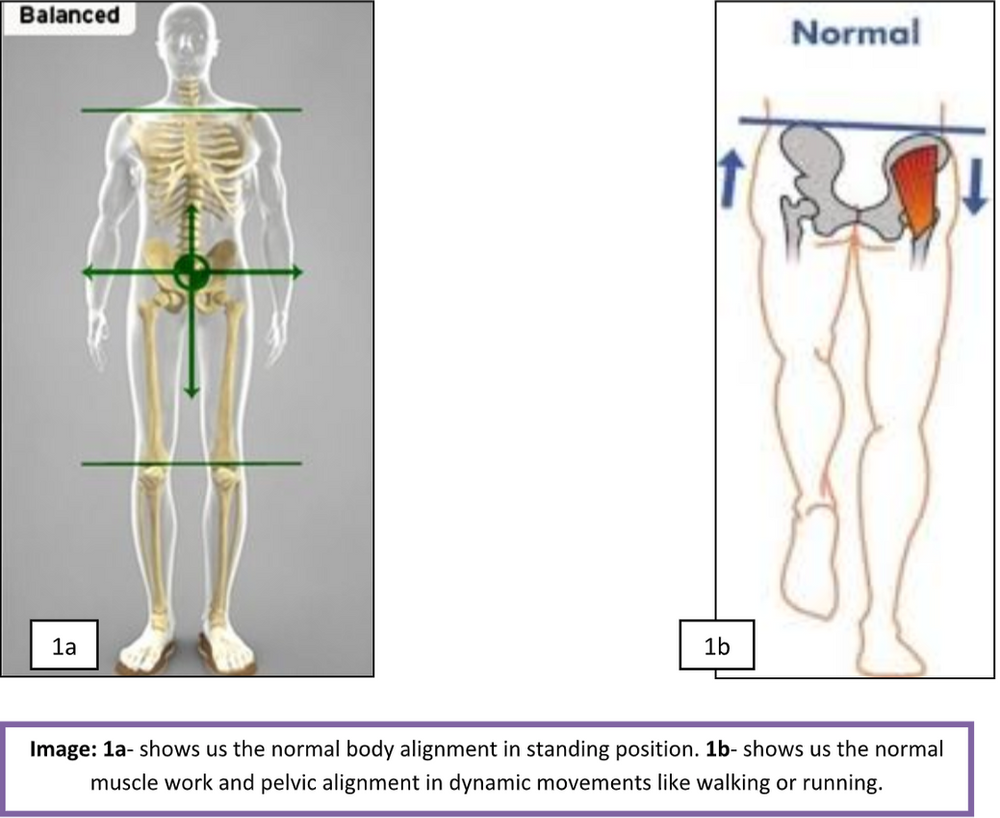 Knee pain, can be a misaligned pelvis or weak hip