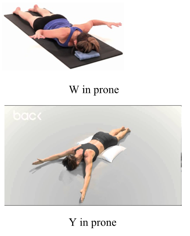 Upper cross syndrome