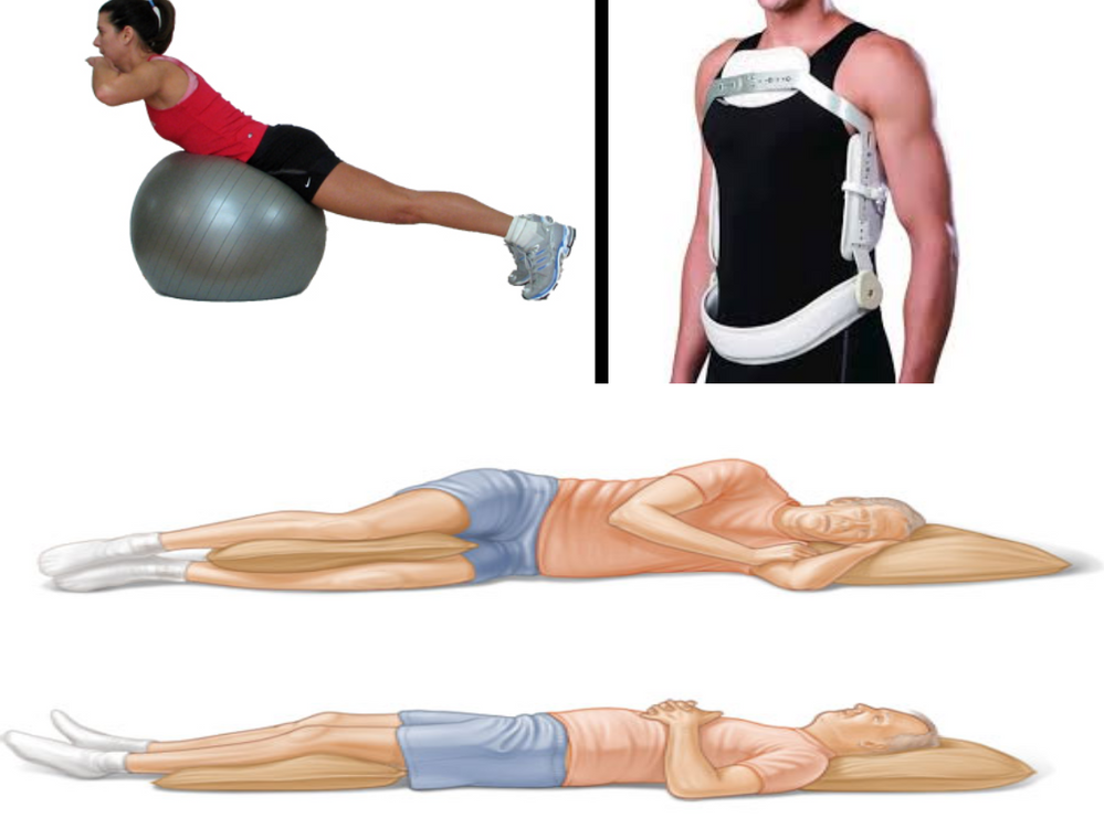 Ankylosing Spondylitis