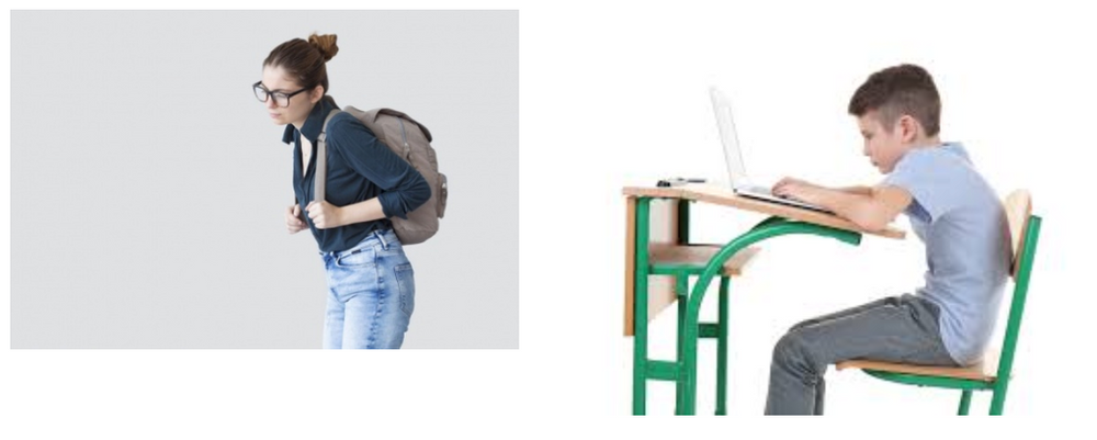 Thoracic Hyperkyphosis