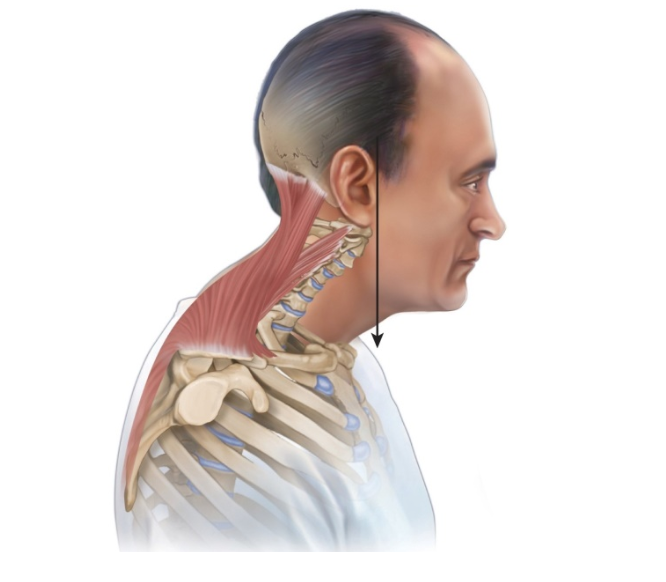 Forward Head Posture
