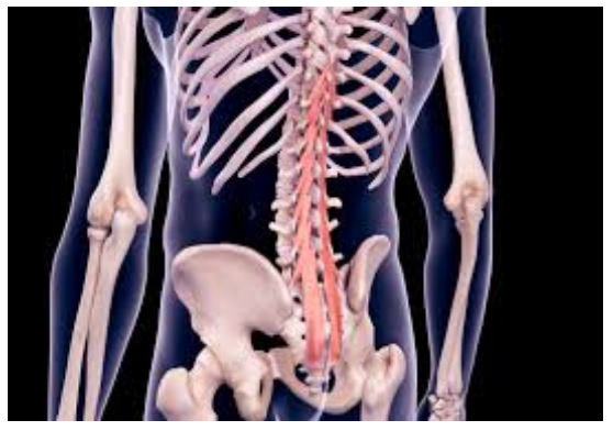 Lumbar Hyperlordosis