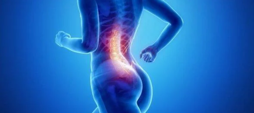 severe hyperlordosis