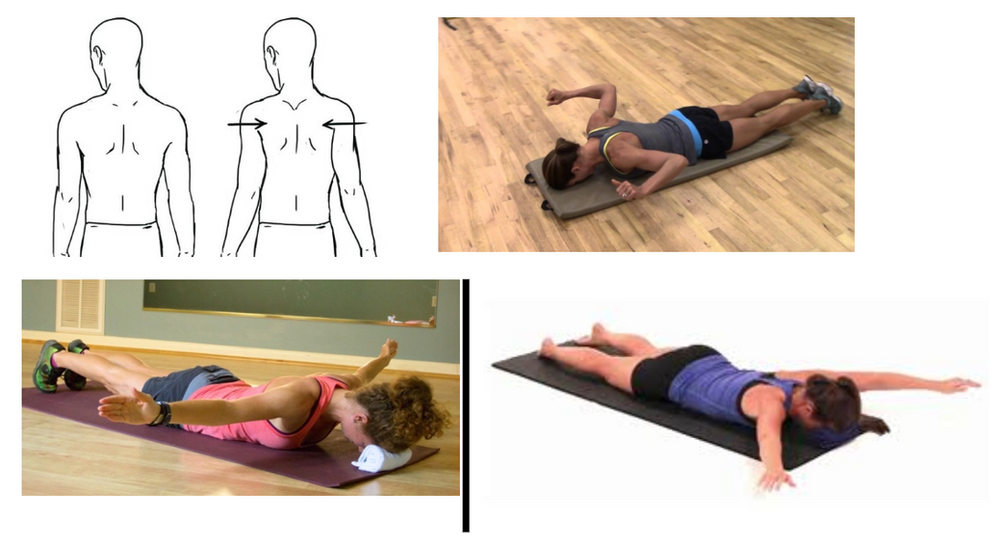 Thoracic Hyperkyphosis
