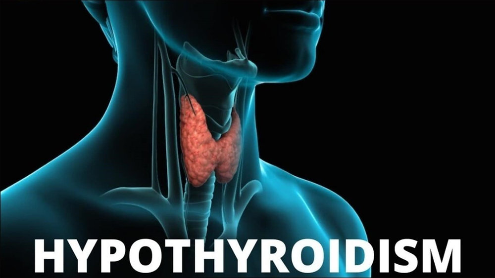 All about Hypothyroidism (Part 3): What are the types of Hypothyroidism?