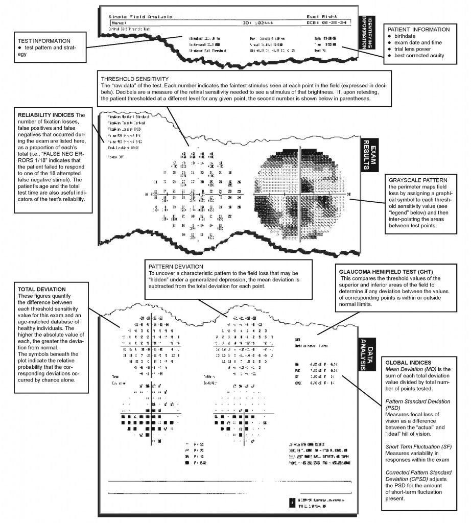 Visual Field Testing Visual Field Testing