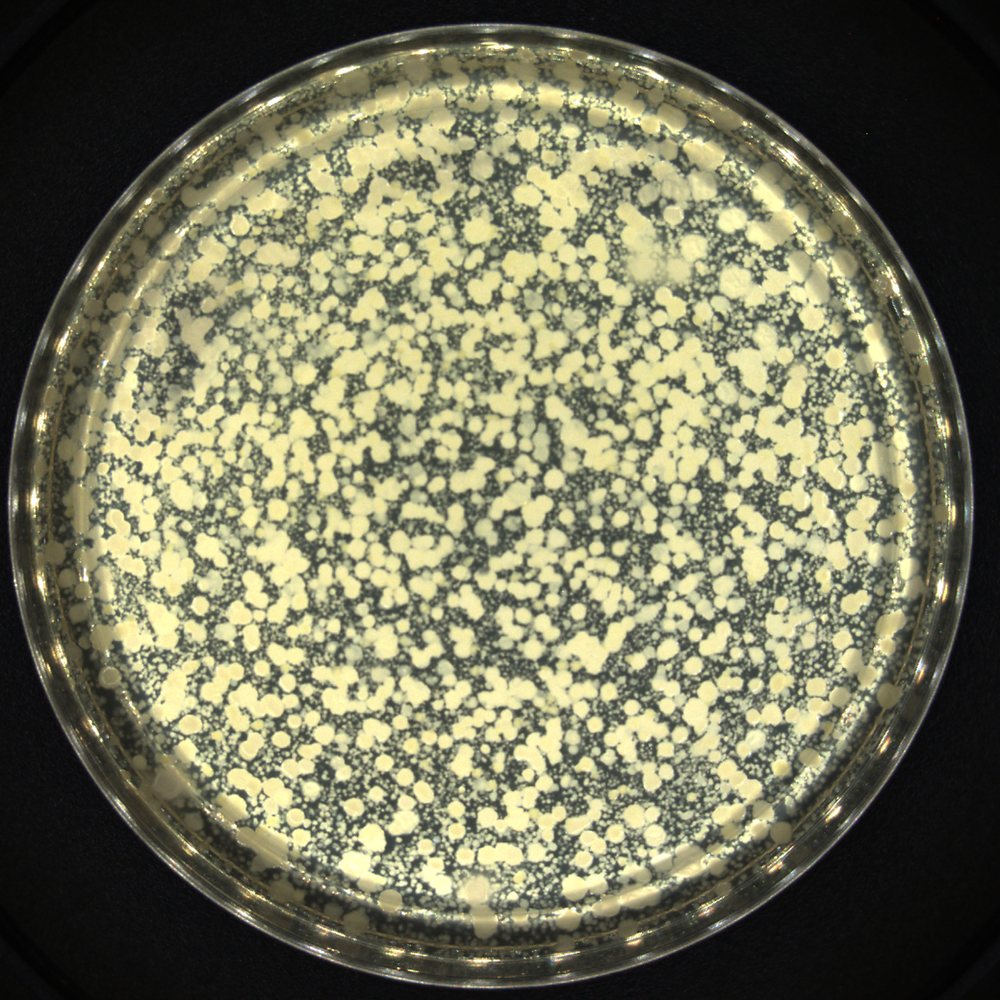 🔬 Plate Count vs. Pathogen Testing: