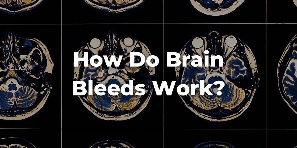 Effects of Brain Bleed From Car Accident