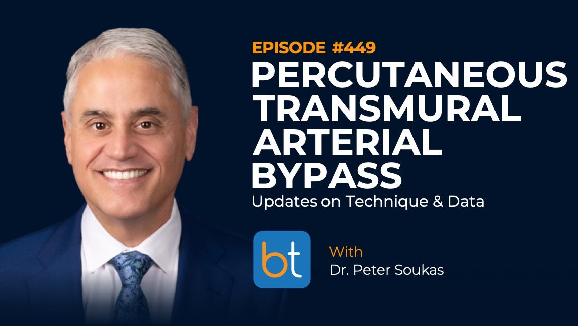 Percutaneous Transmural Arterial Bypass: Updates on Technique & Data ...