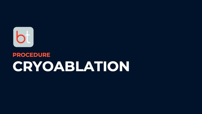 Cryoablation Podcasts