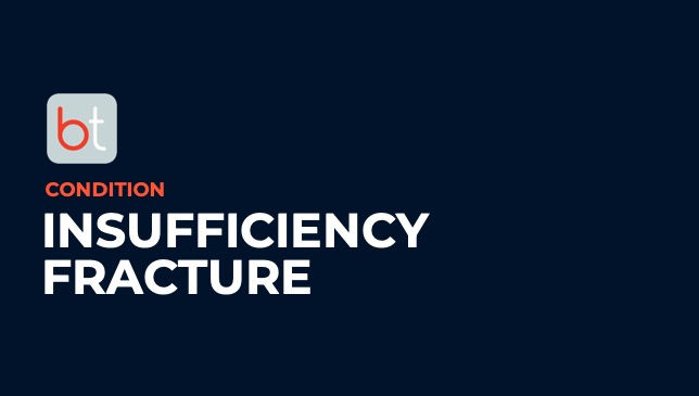 Insufficiency Fracture Podcasts