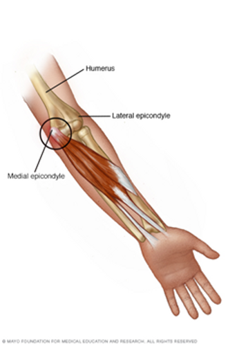 Medial Epicondylitis Exercises