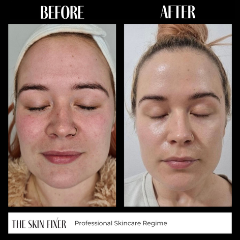The Skin Fixer | Skin Treatments | Facials | Skin Correction | Melbourne
