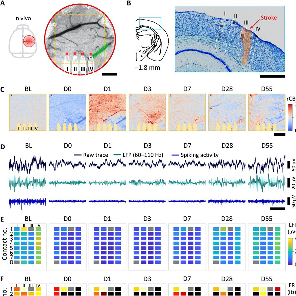 22. Multimodal mapping of neural activity and cerebral blood flow ...