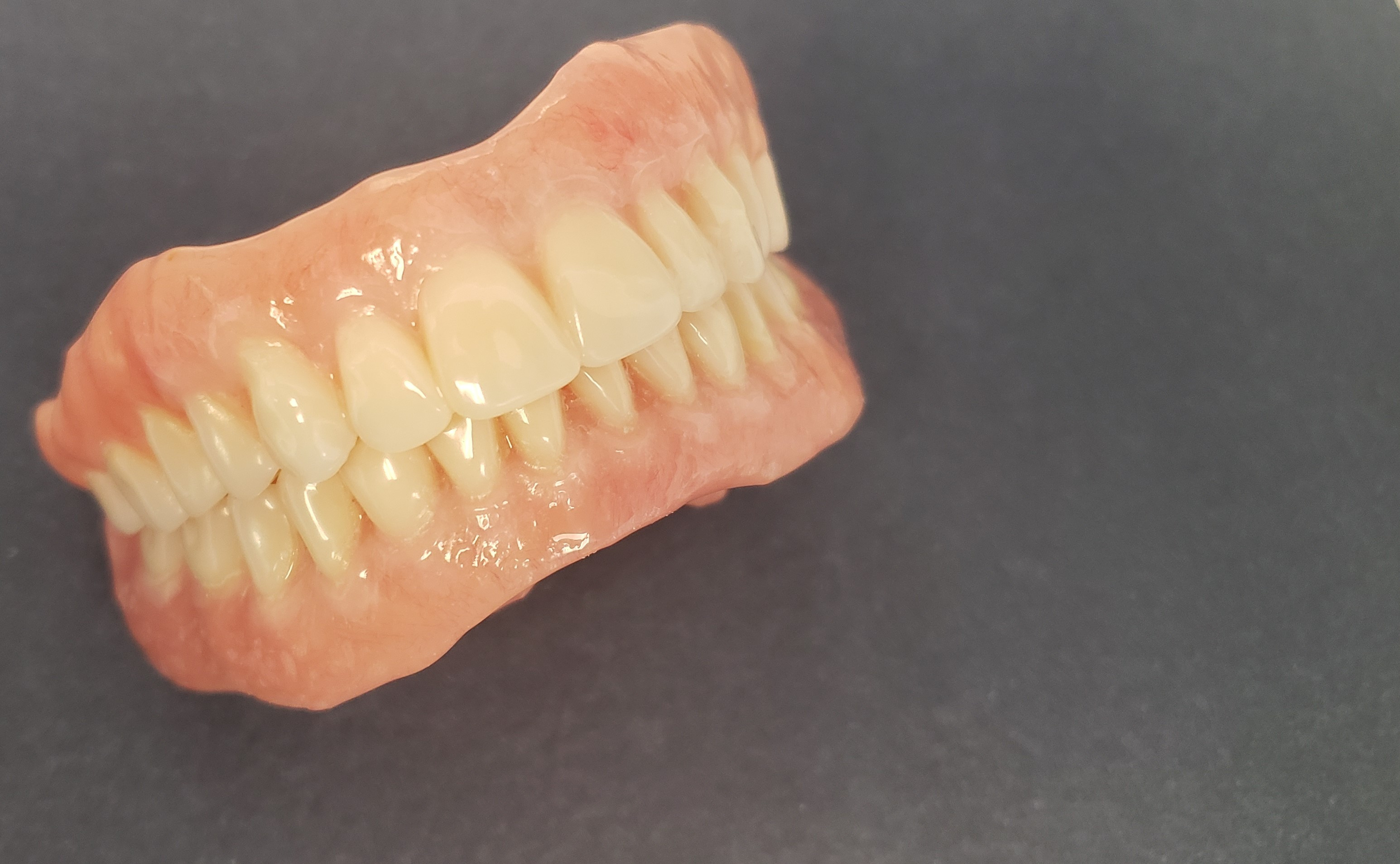 Complete Dentures