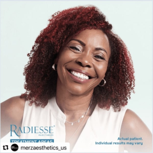 Radiesse Injectables | Euro Laser Spa