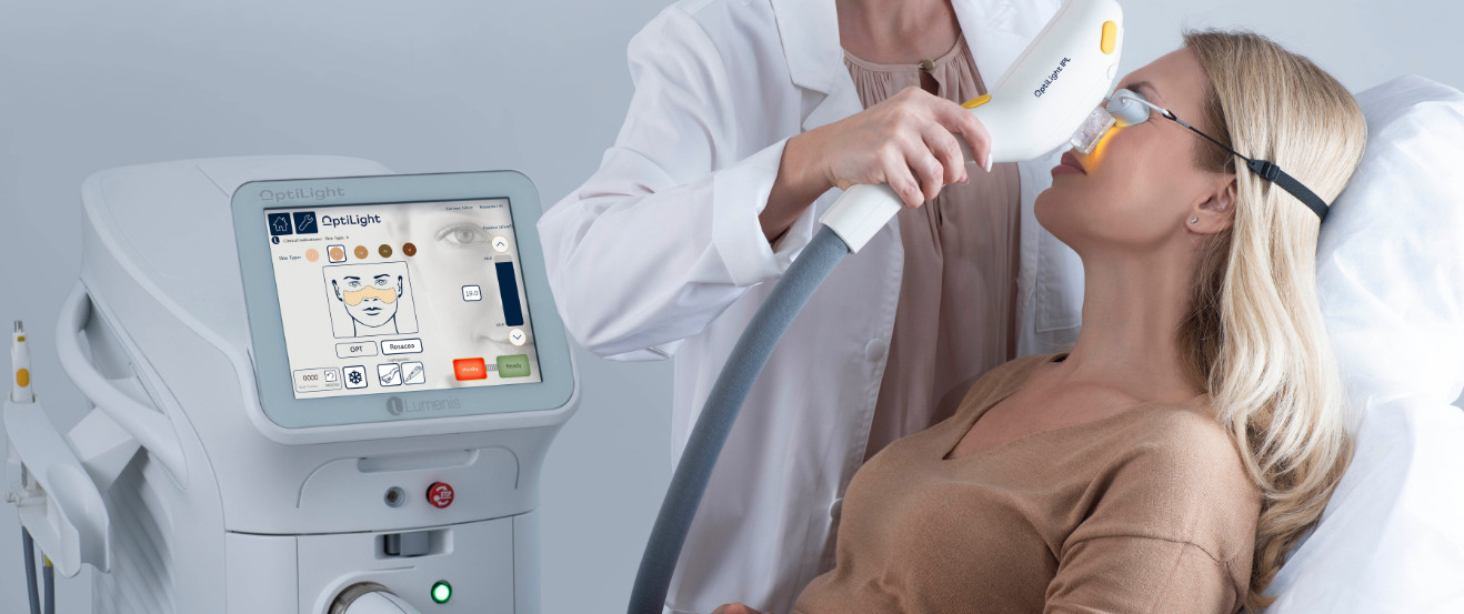 IPL Treatment with OptiLight: Revolutionizing Dry Eye Care