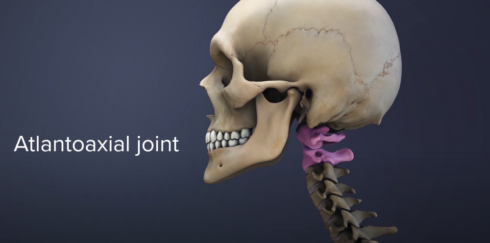 Neck pain? Stabilising the atlantoaxial joint