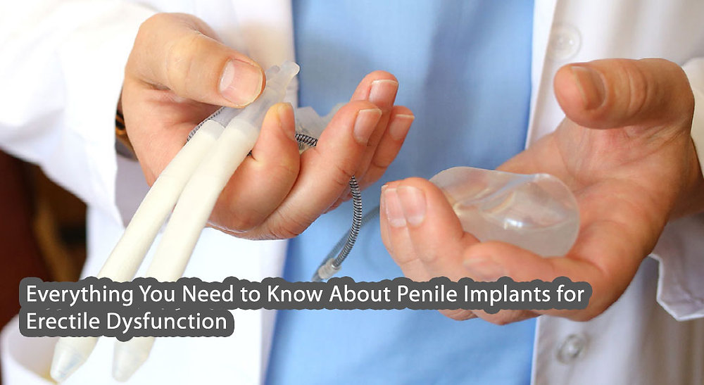 Everything You Need to Know About Penile Implants for Erectile Dysfunction