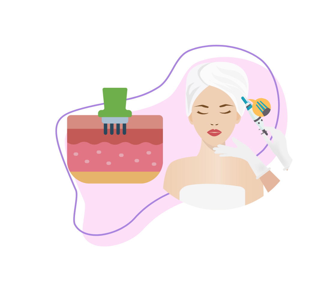 Microneedling | Epicare Health