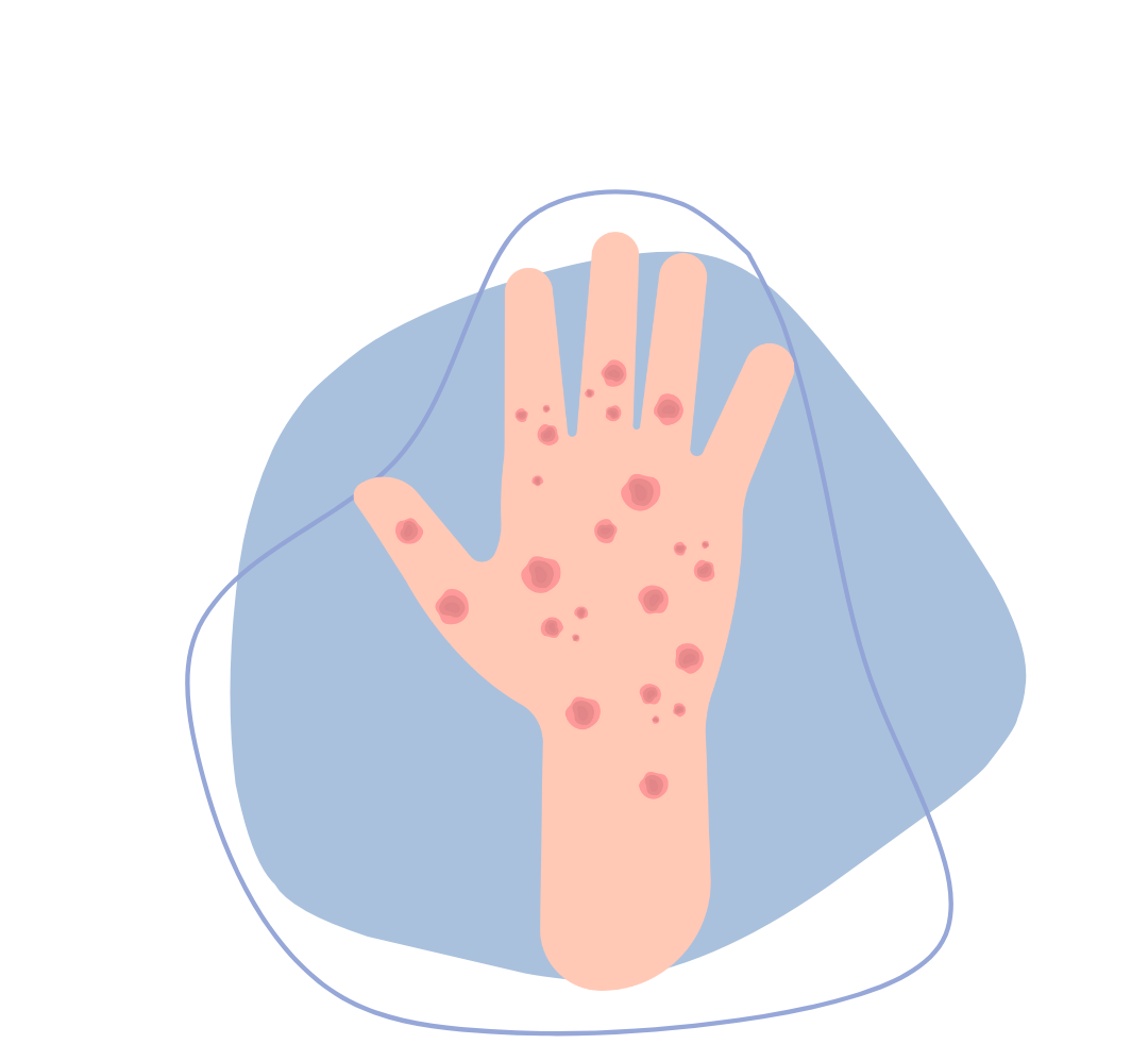 STI Routine screen with Syphilis
