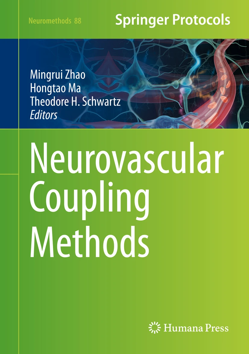 RESEARCH | Theodore H. Schwartz