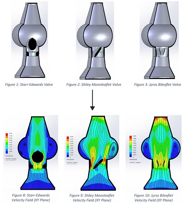 CFD Analysis of Heart Valves | Nishant Chitluru's Design Portfolio