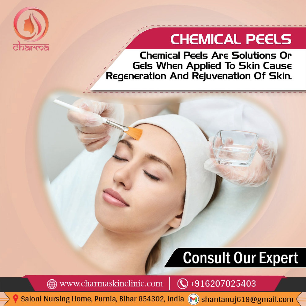 Best Chemical Peel Treatment in Purnia Bihar - Saloni Nursing Home