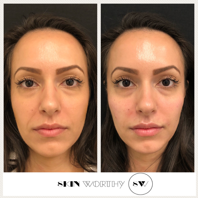 Transformation Thursday: Inspiring Stories of Skin-Worthy Transformations