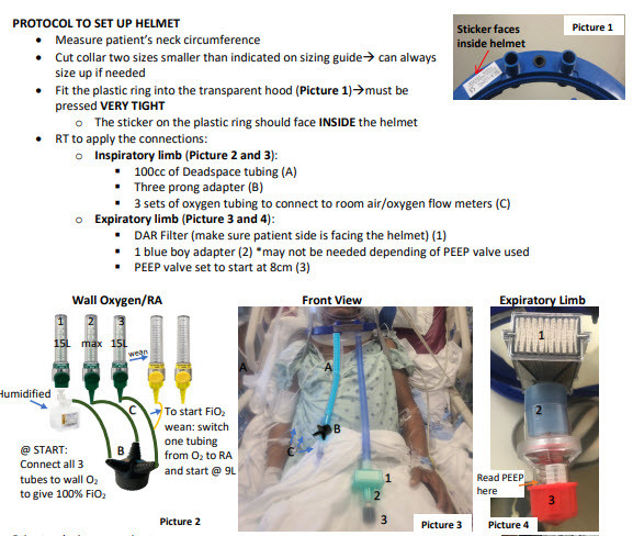 Protocols and Guidelines about Helmet Ventilation (NIV)