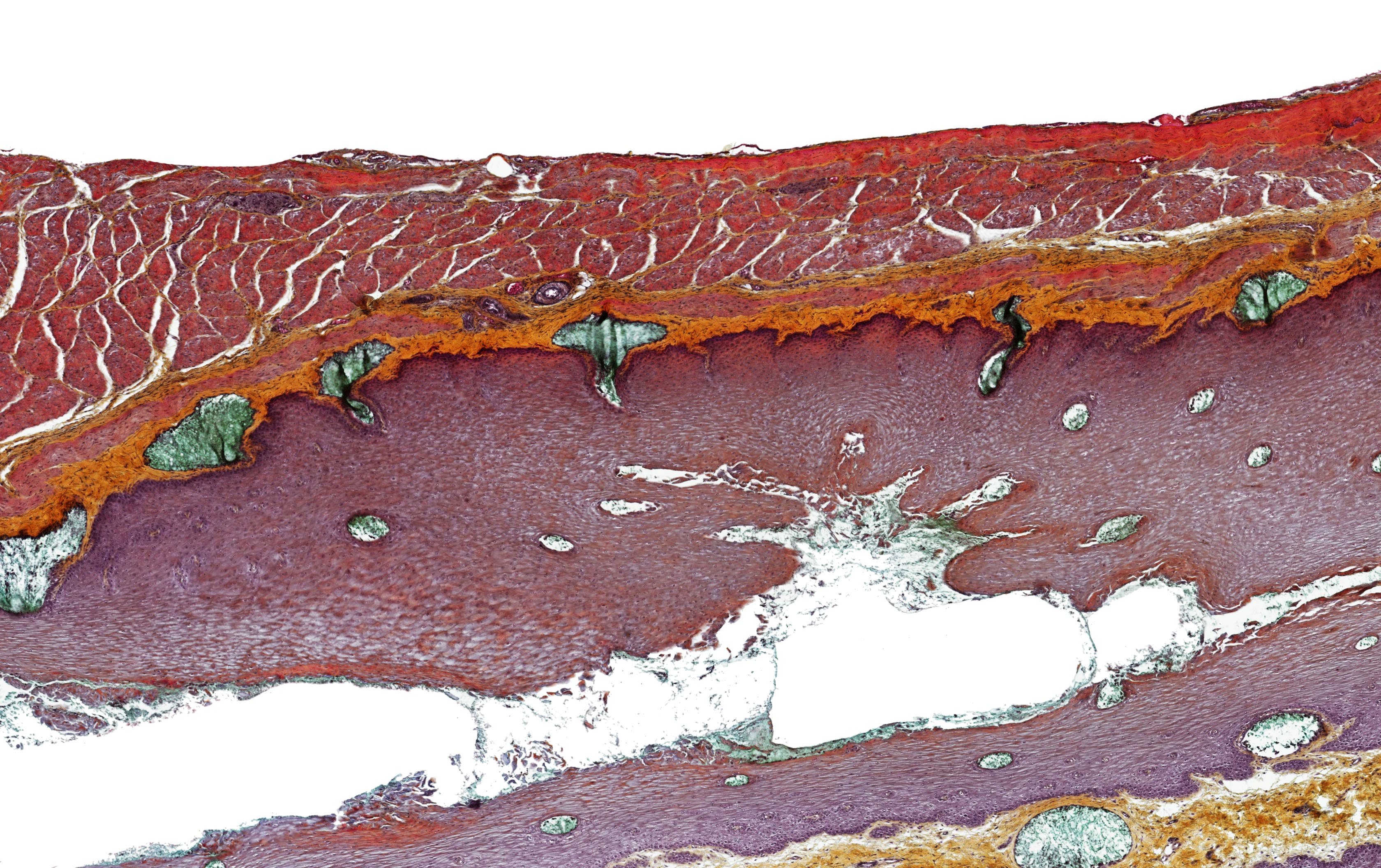 Coloration - Movat Pentachrome | althisia