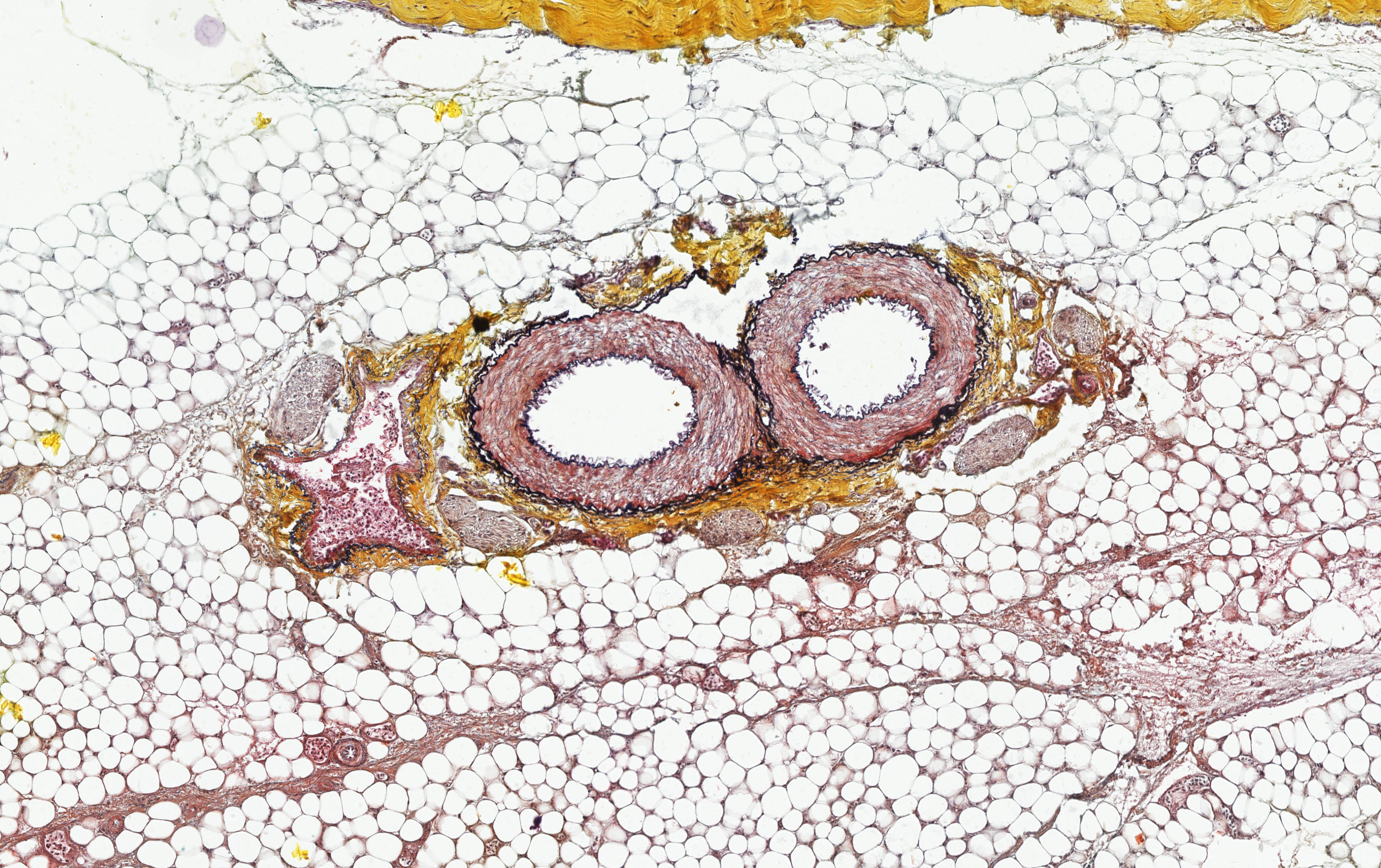 Coloration - Movat Pentachrome | althisia