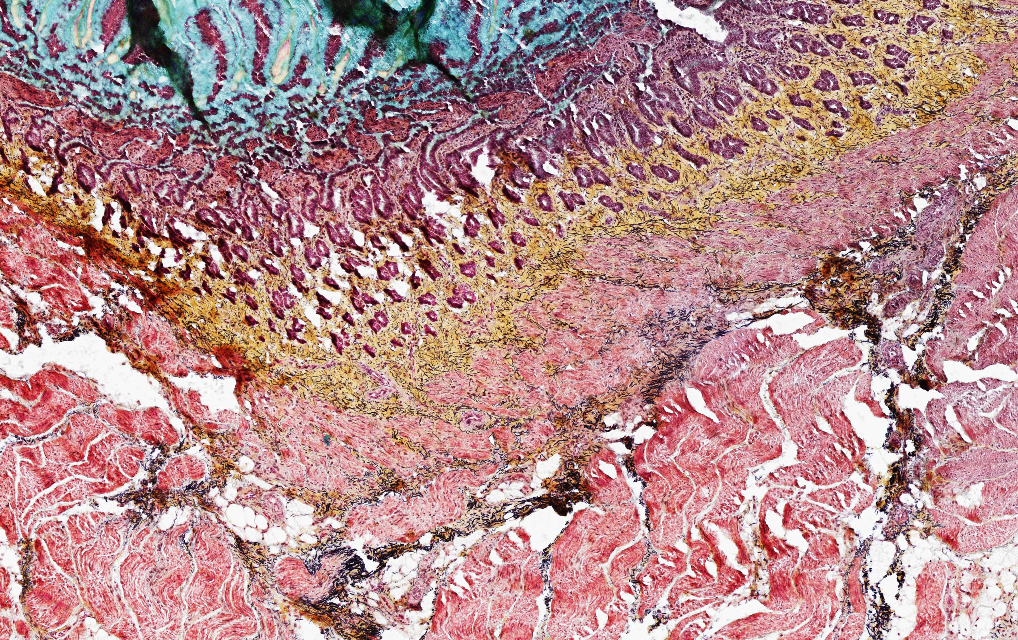 Coloration - Movat Pentachrome | althisia