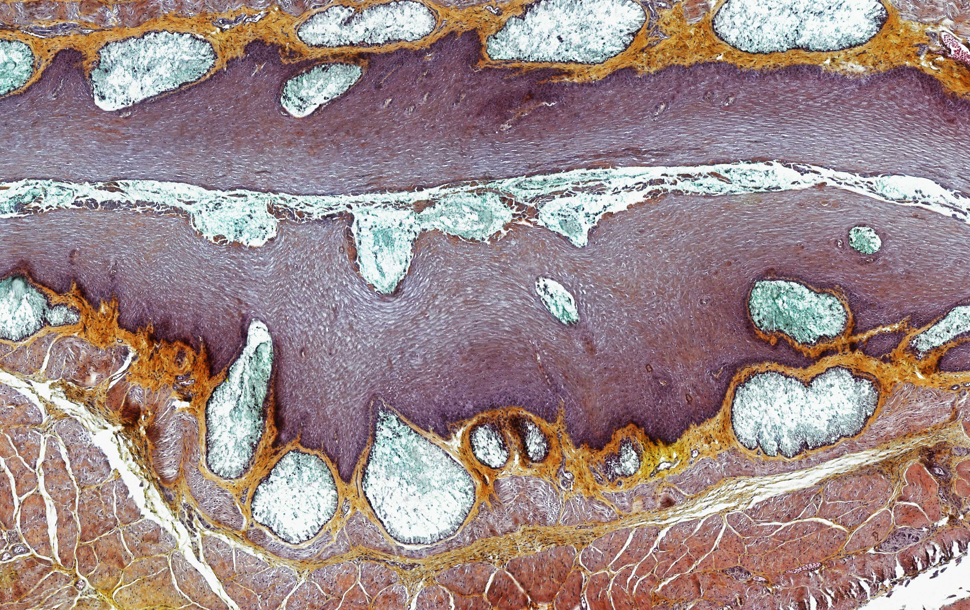 Coloration - Movat Pentachrome | althisia