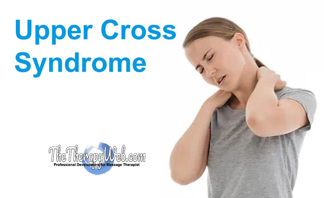 Understanding Upper Cross Syndrome: A Quick Overview