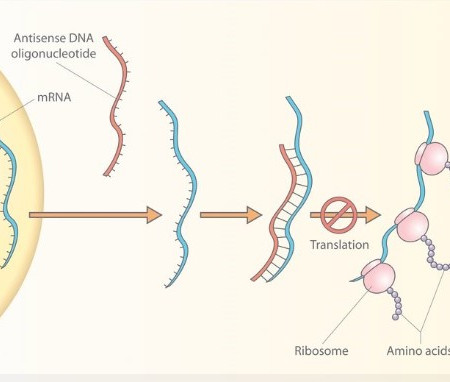 Antisense oligonucleotide gene therapy for treating Huntington's ...