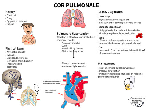 Cardiovascular | themedicallyinclined