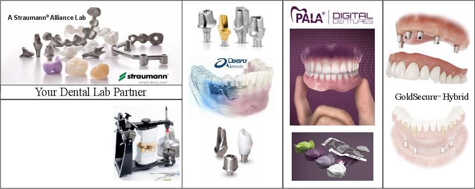 Keystone Restore Implant Catalog - Catalog Library