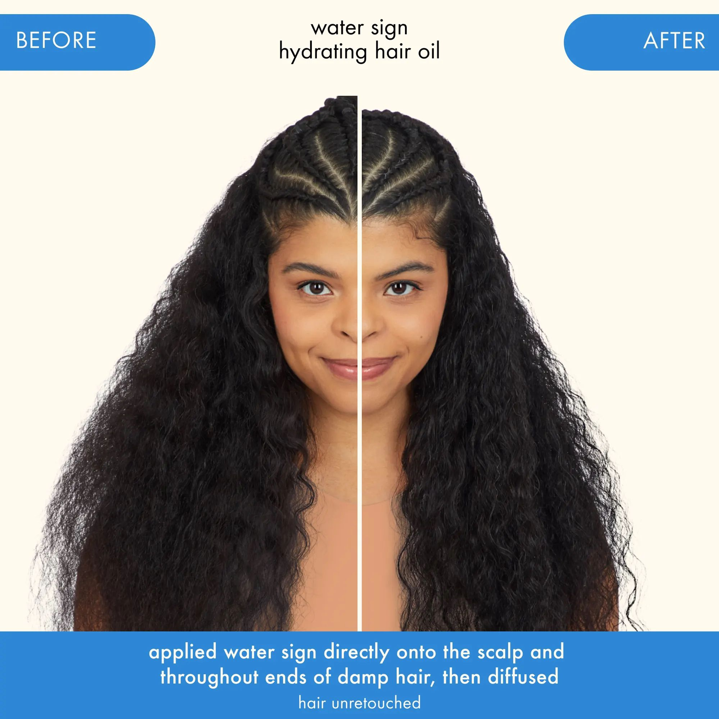 Scalp Snowflakes? Beat the Seasonal Dry Scalp Blues and get rid of Dandruff